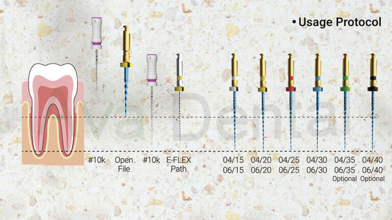 فایل روتاری بلو ایتیس Eighteeth E-Flex Blue دنکو | آوادنتال